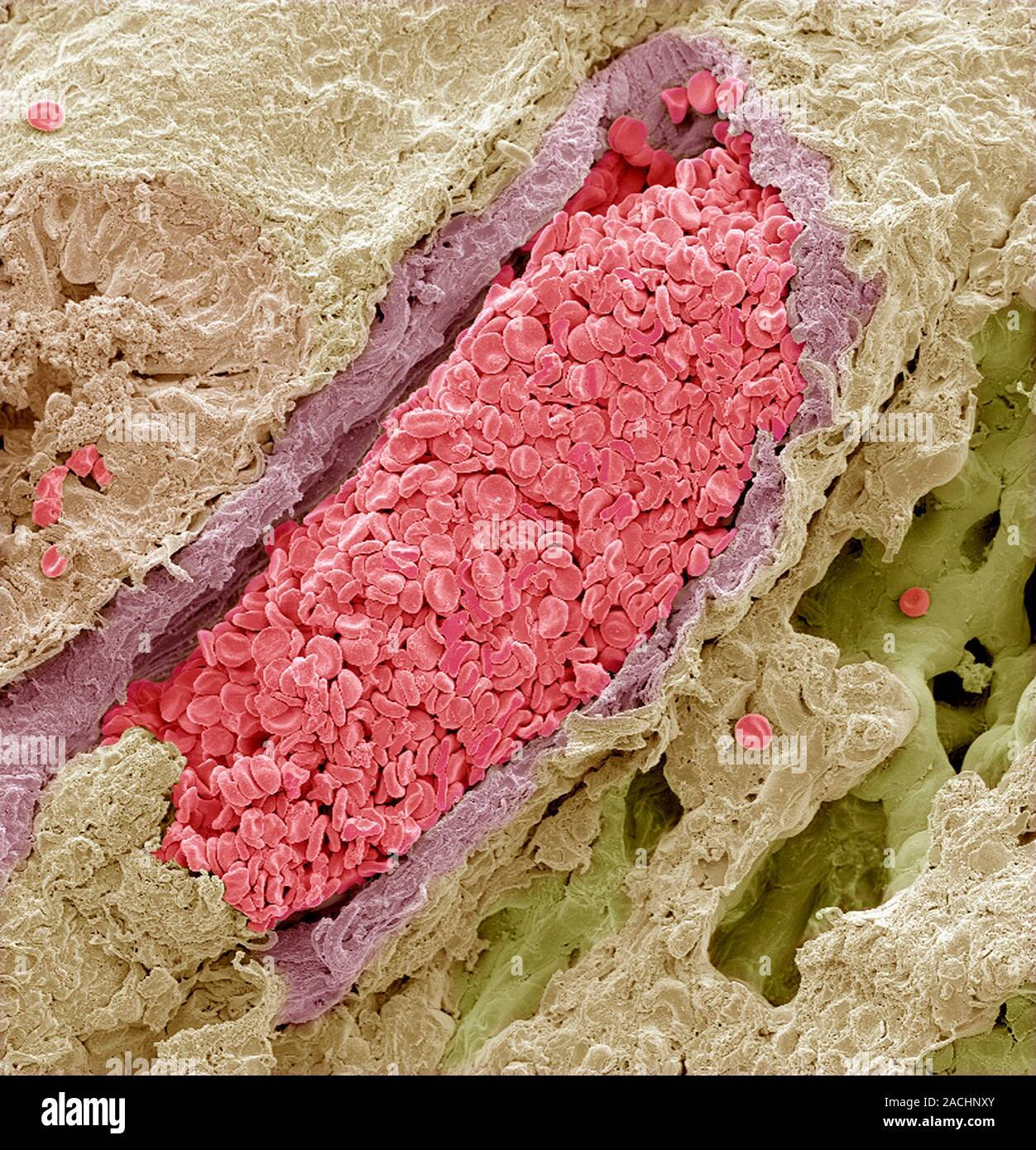Blood-filled pulmonary vein. Coloured scanning electron micrograph (SEM ...