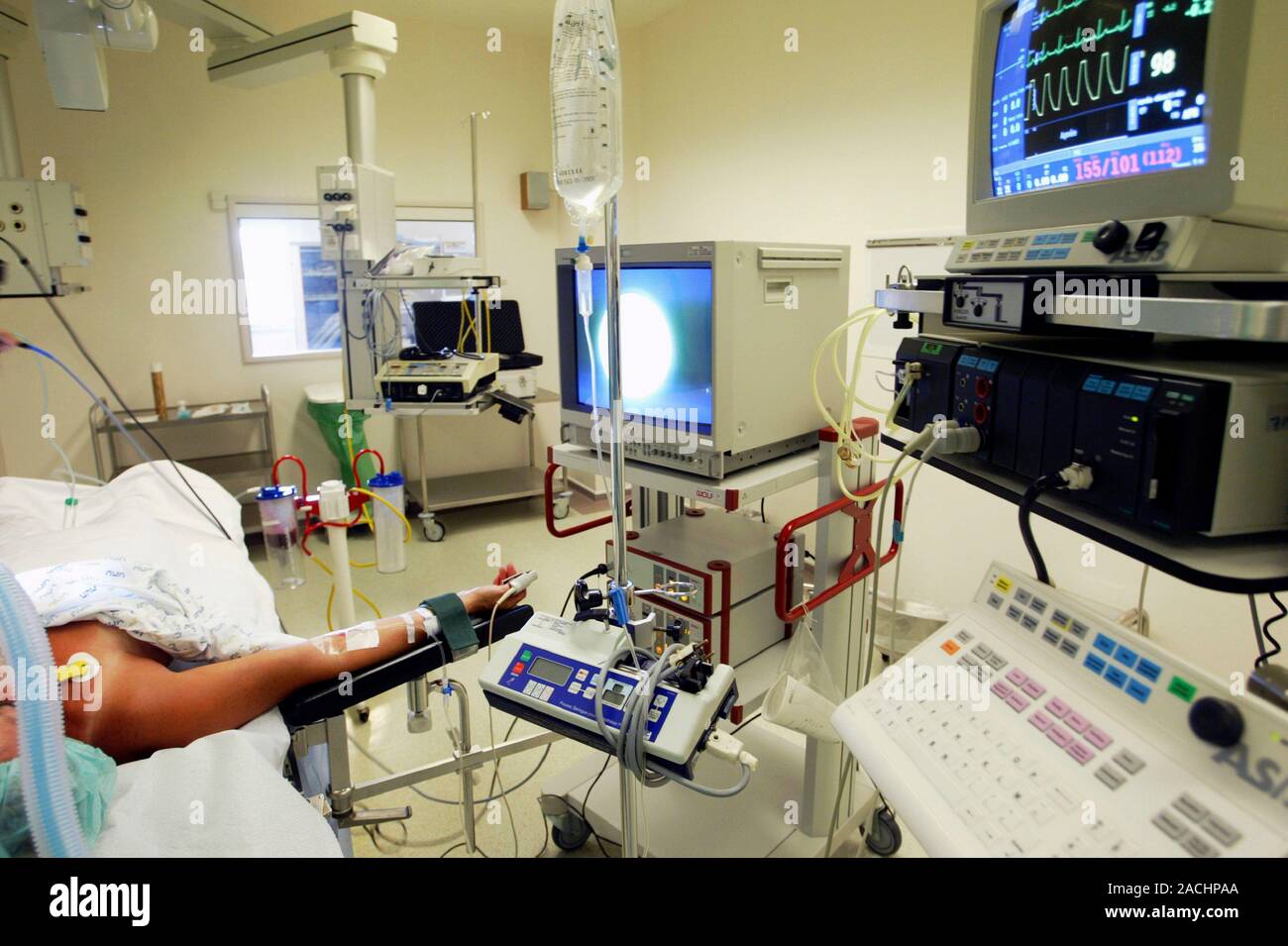 Diagnosing cancer. Patient undergoing bronchial fibroscopy to ...