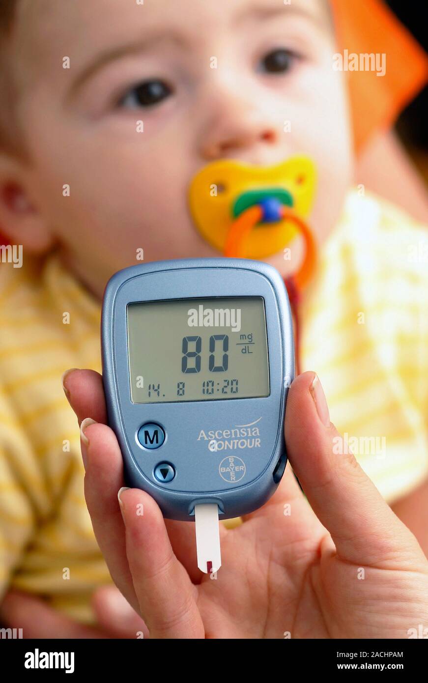 Blood glucose test. Glucometer being used to test a toddler's blood ...