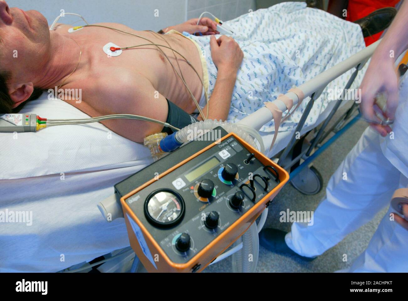 Emergency hospital treatment. Patient attached to an ECG ...