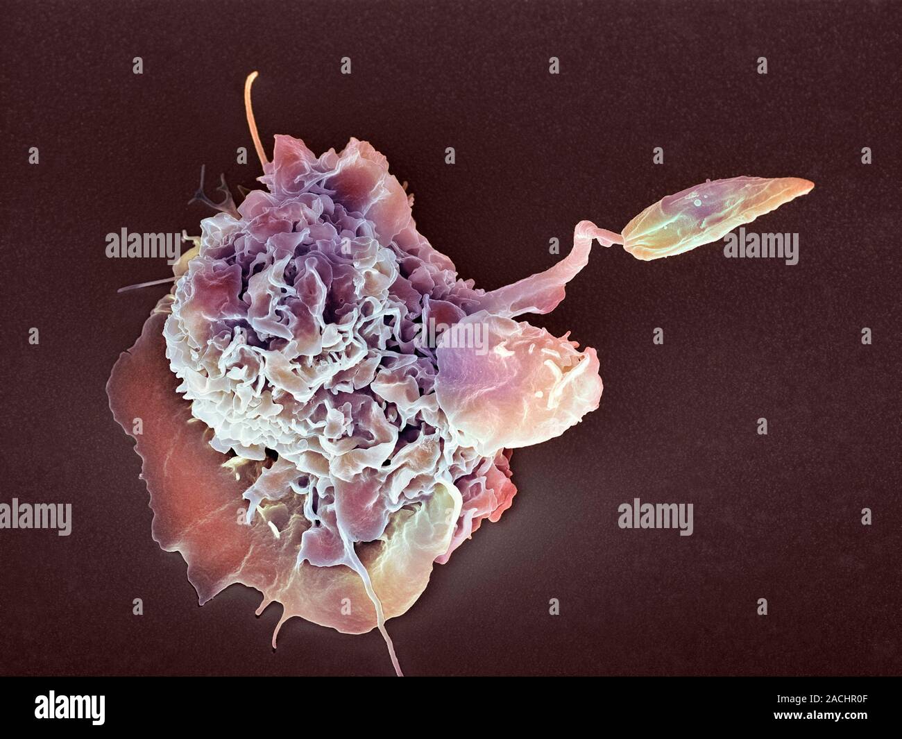 Macrophage attacking a foreign body. Coloured scanning electron micrograph (SEM) of a macrophage ...