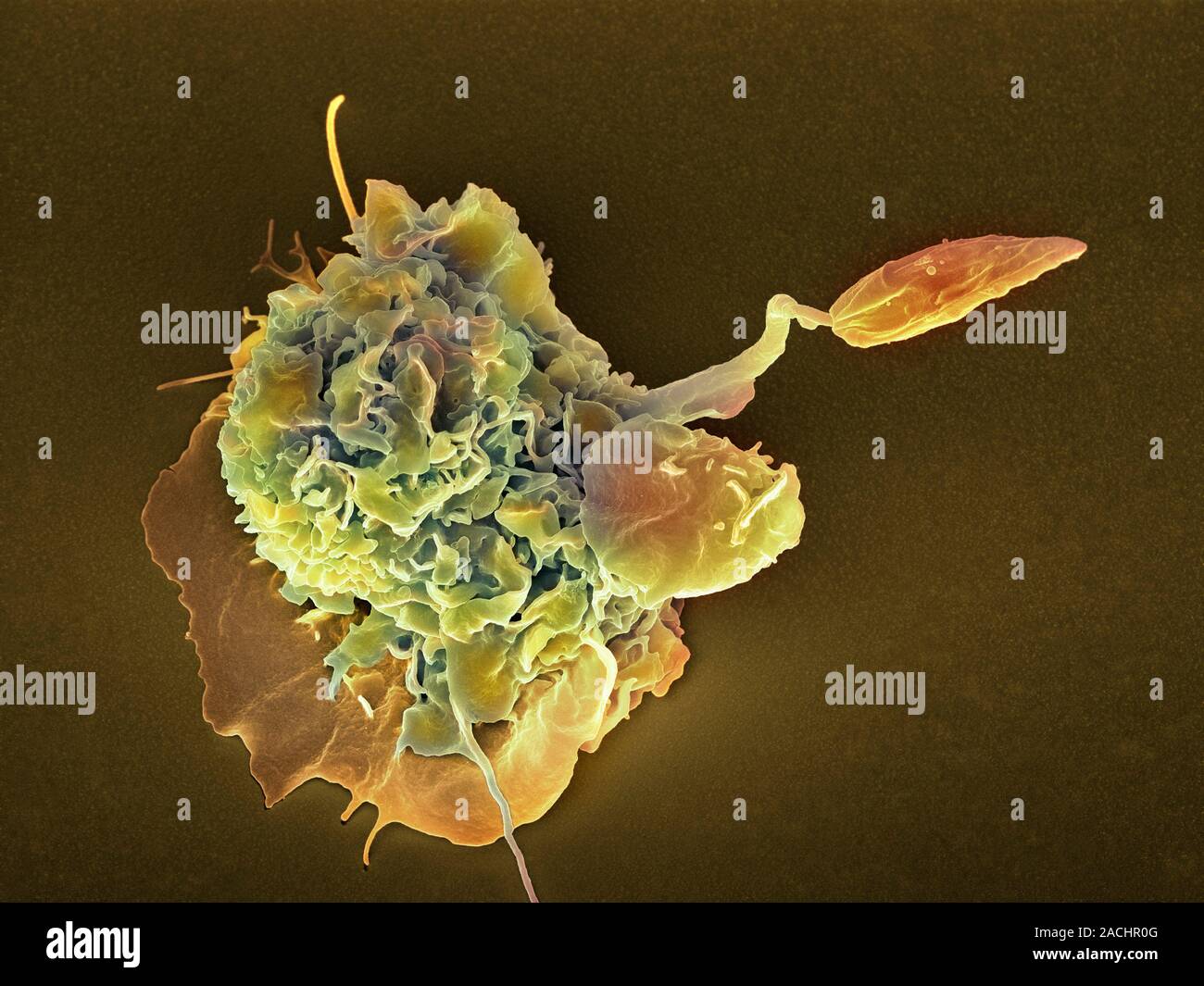 Macrophage attacking a foreign body. Coloured scanning electron micrograph (SEM) of a macrophage ...