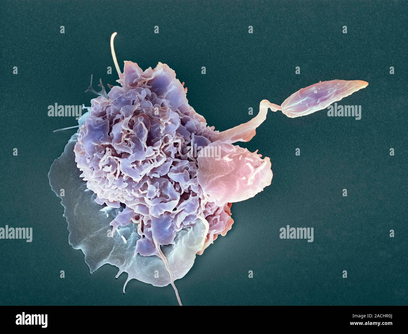 Macrophage attacking a foreign body. Coloured scanning electron micrograph (SEM) of a macrophage ...