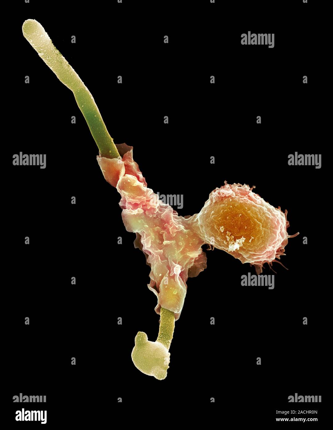 Neutrophil engulfing fungus. Coloured scanning electron micrograph (SEM ...