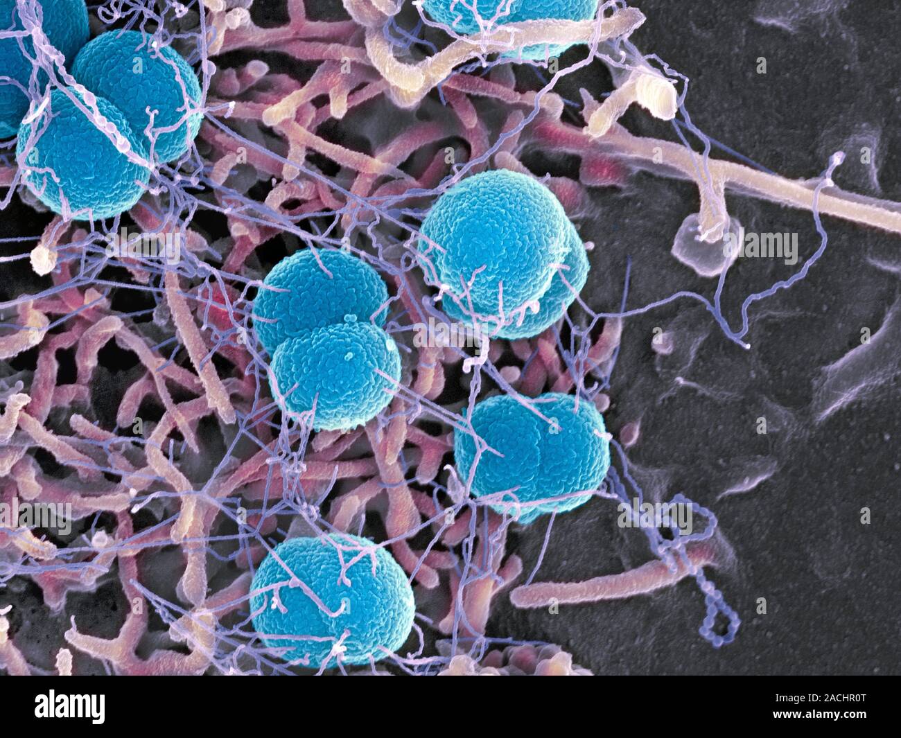 Meningitis bacteria. Coloured scanning electron micrograph (SEM) of ...