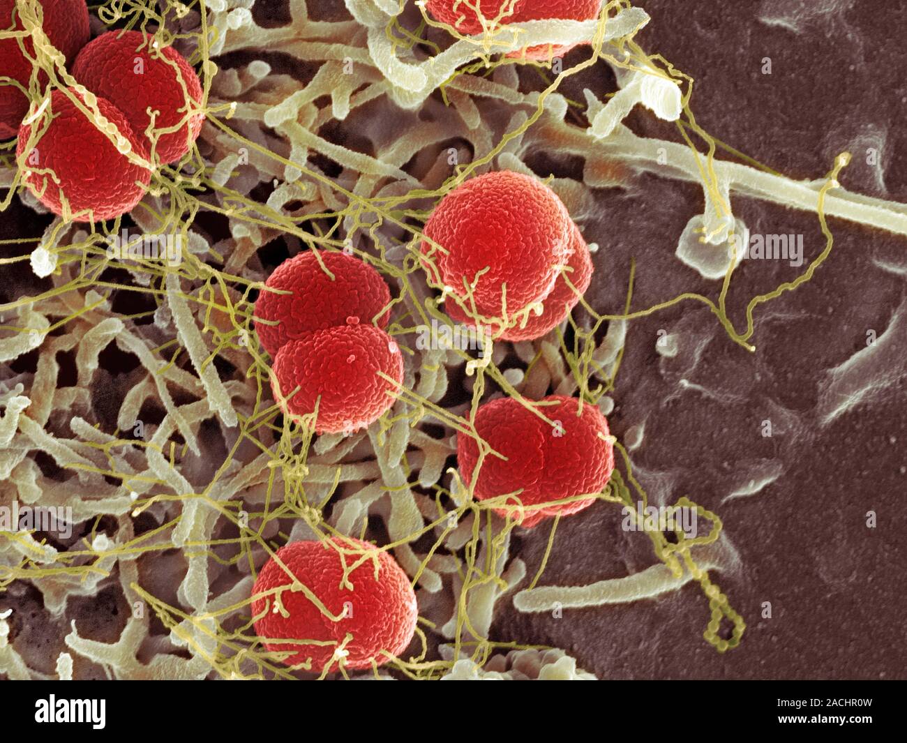 Meningitis bacteria. Coloured scanning electron micrograph (SEM) of ...