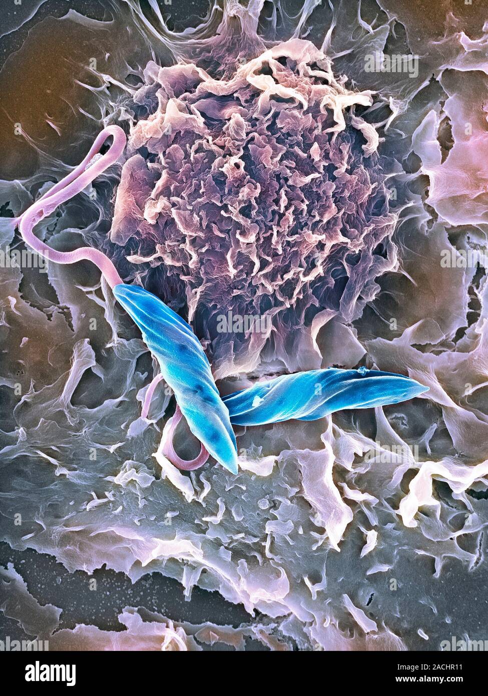 Macrophage attacking a foreign body. Coloured scanning electron micrograph (SEM) of a macrophage ...