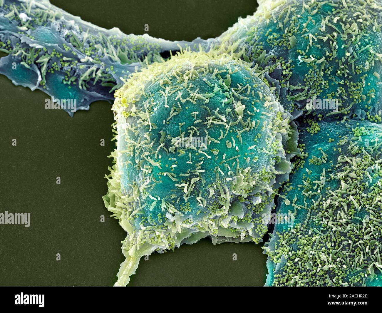 Herpes virus. Coloured scanning electron micrograph (SEM) of epithelial ...