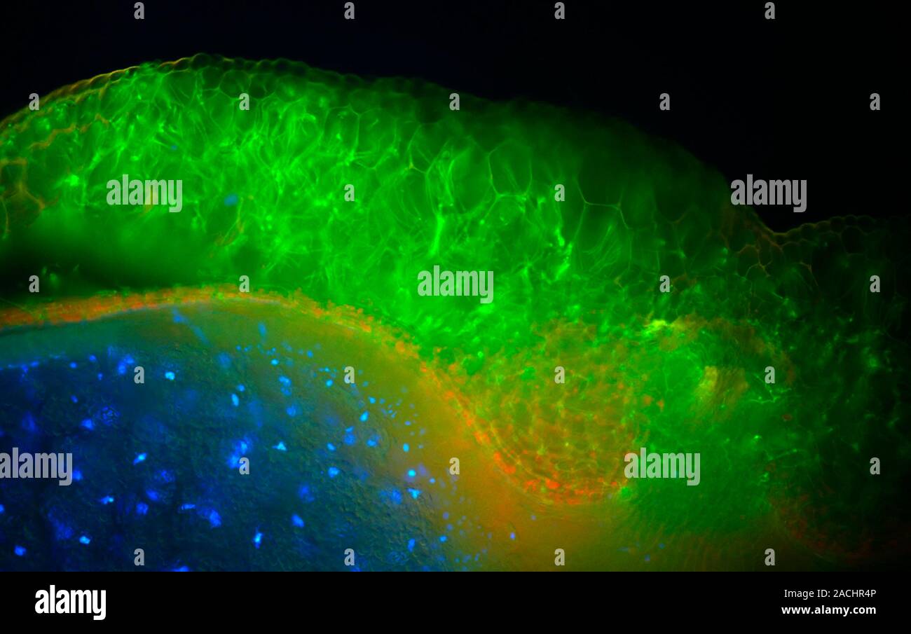 Plant fungus resistance research. Fluorescence micrograph of a section ...