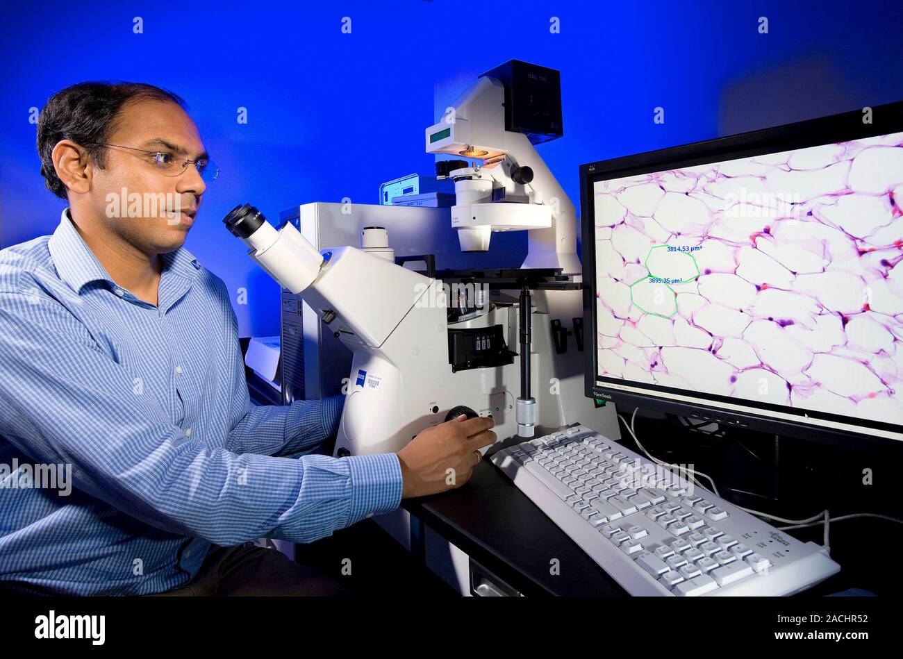 Obesity research. Researcher analysing rat fat cells under a microscope ...