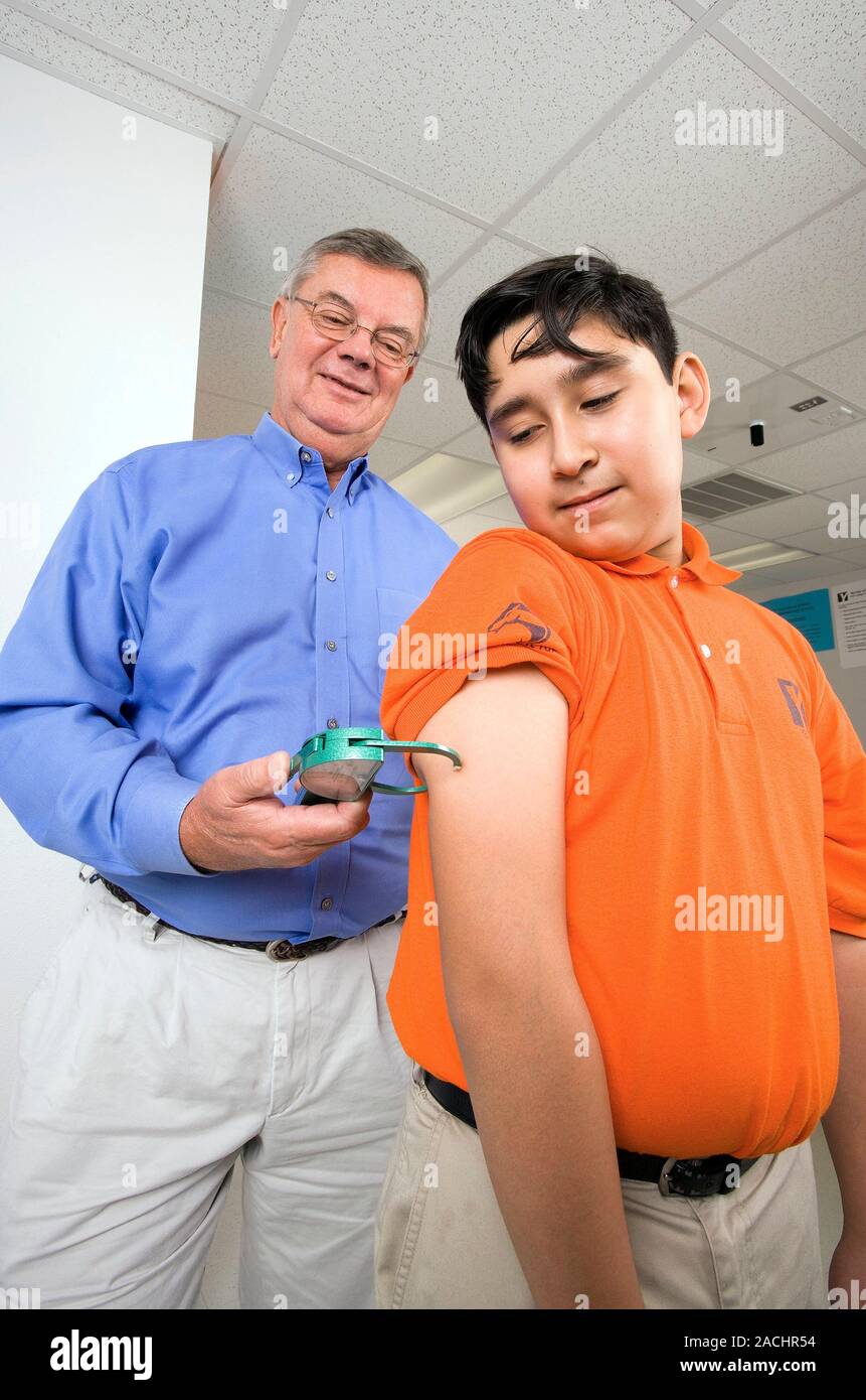 Measuring body fat. Researcher taking a tricep skinfold measurement of ...