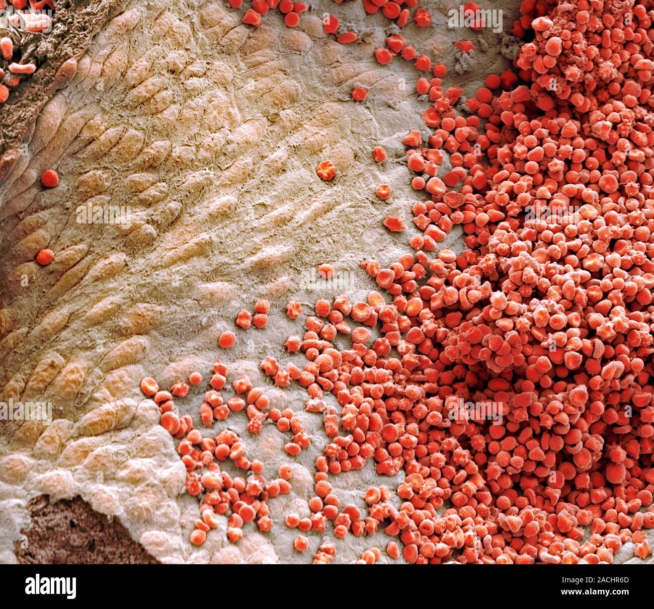 Heart ventricle. Coloured scanning electron micrograph (SEM) of a ...