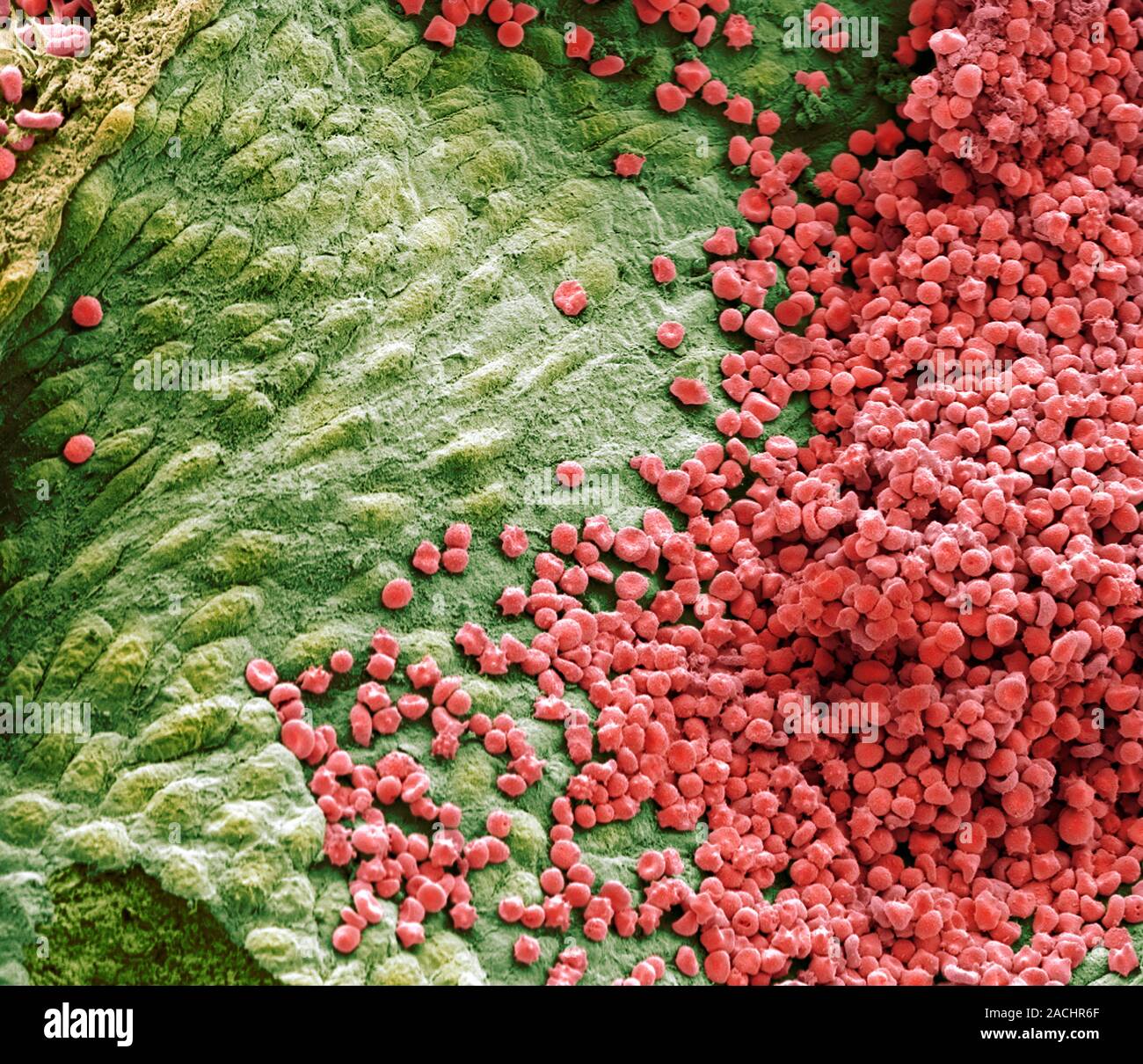 Heart ventricle. Coloured scanning electron micrograph (SEM) of a ...