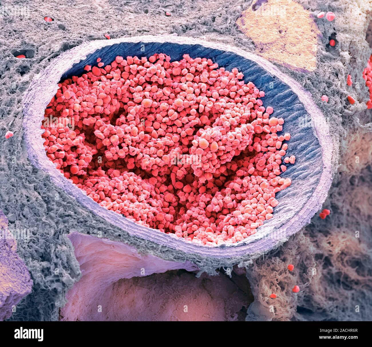 Blood-filled foetal aorta. Coloured scanning electron micrograph (SEM ...