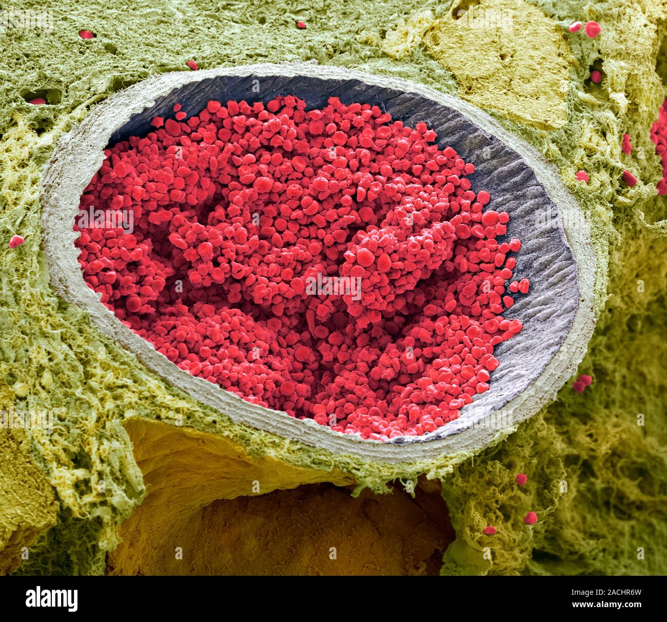 Blood-filled foetal aorta. Coloured scanning electron micrograph (SEM ...