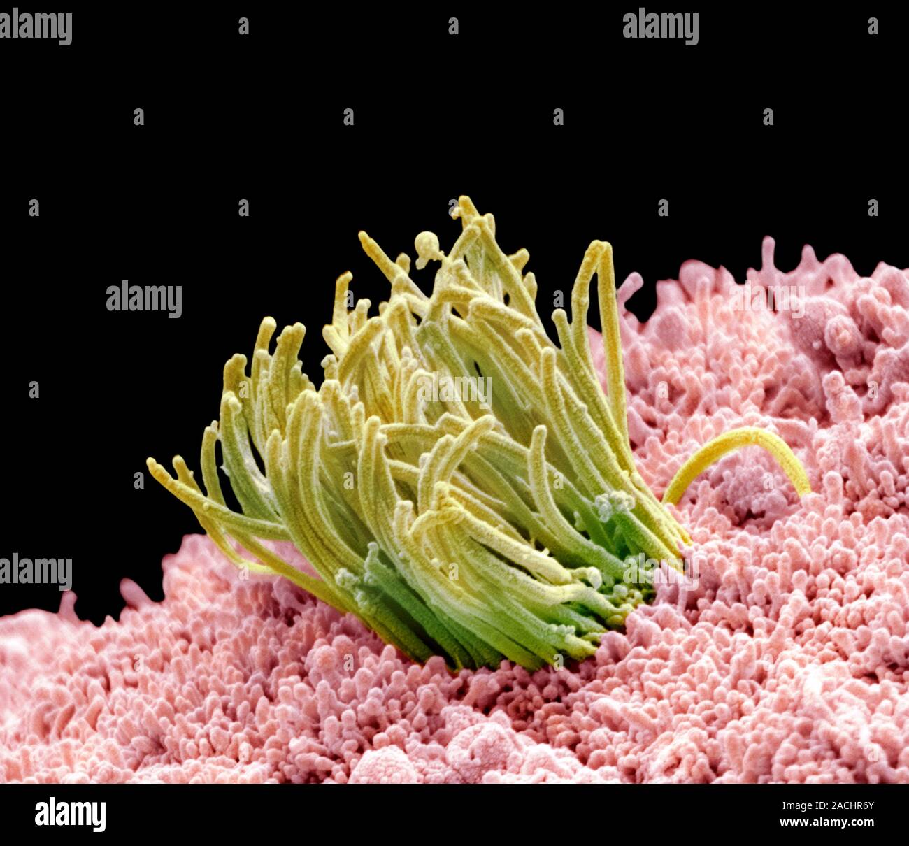 Fallopian tube. Coloured scanning electron micrograph (SEM) of the ...