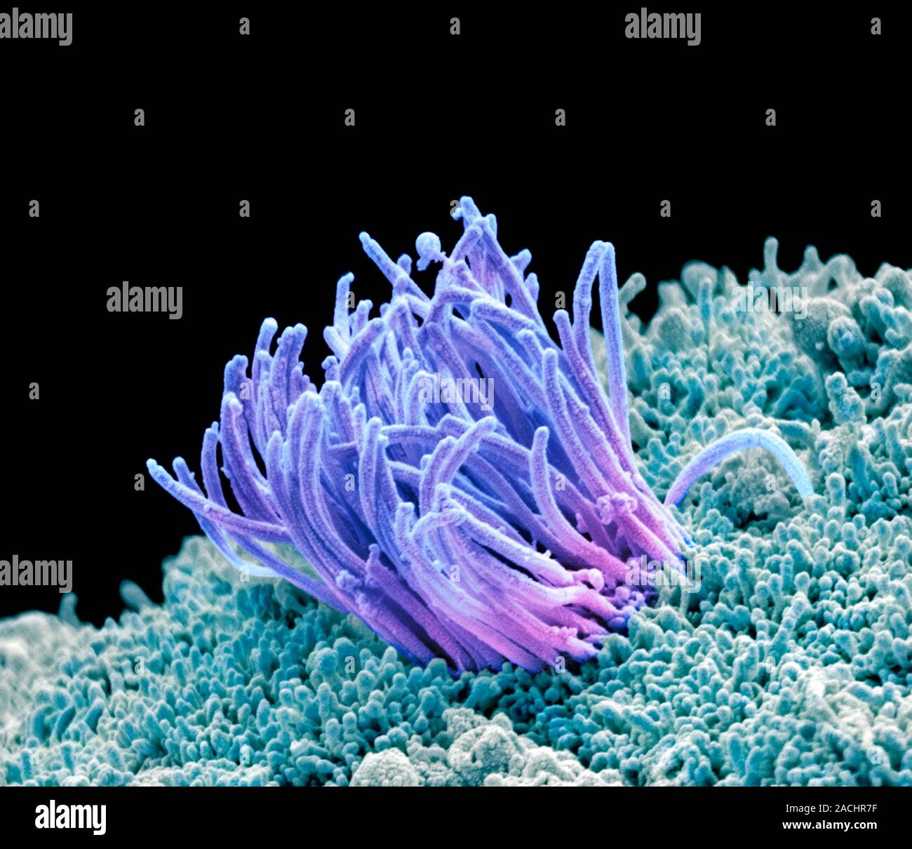 Fallopian tube. Coloured scanning electron micrograph (SEM) of the ...