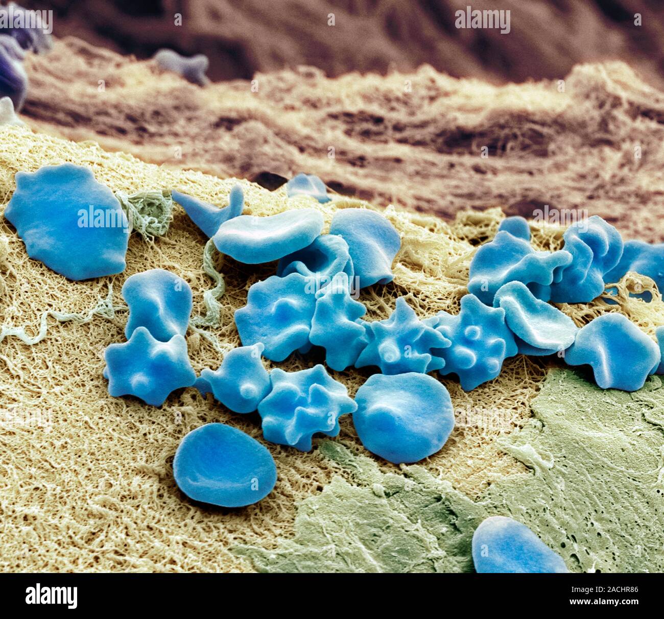 Red blood cells. Coloured scanning electron micrograph (SEM) of red ...