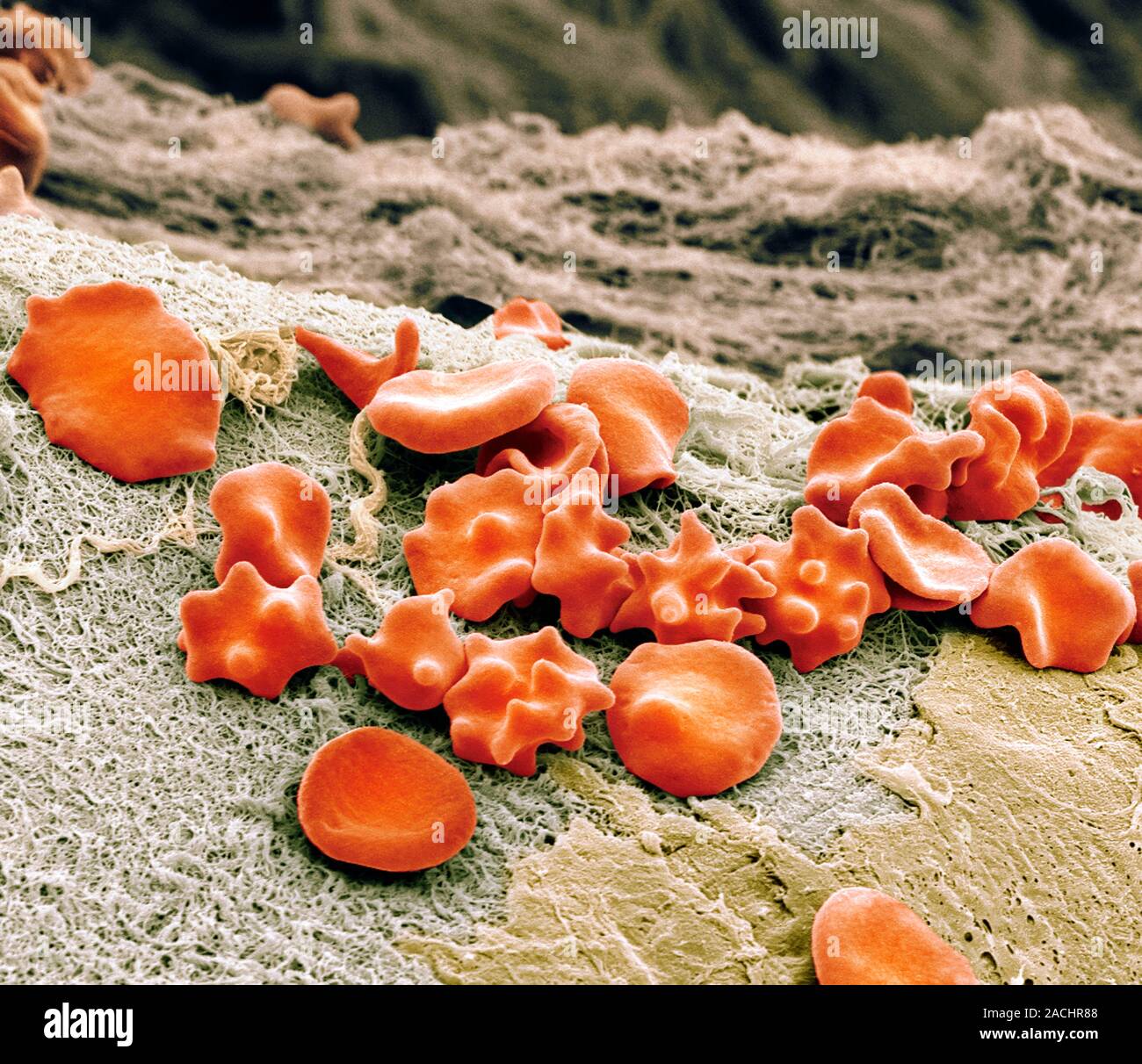 Red blood cells. Coloured scanning electron micrograph (SEM) of red ...