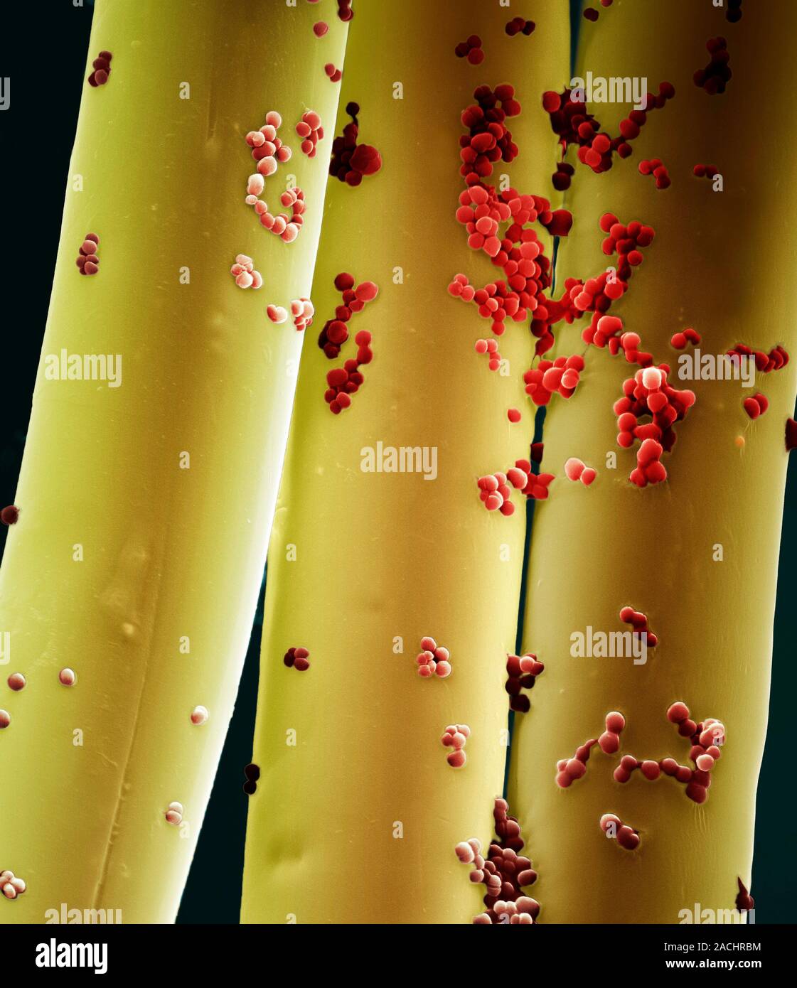 MRSA bacteria, coloured scanning electron micrograph (SEM). Methicillin ...