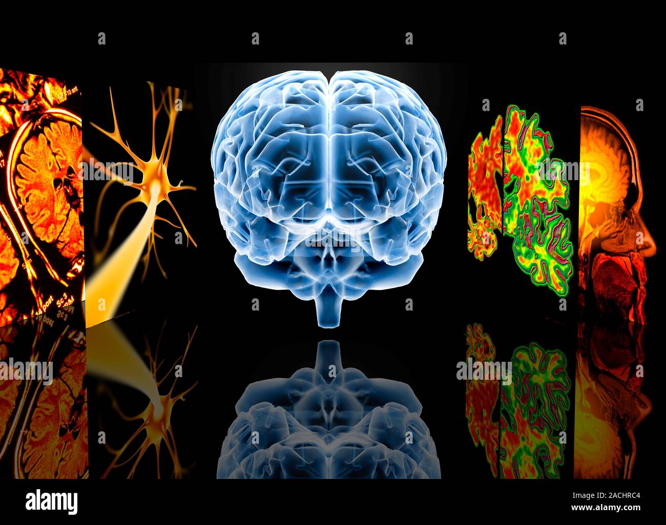 Conceptual computer artwork depicting neurology. From left to right ...