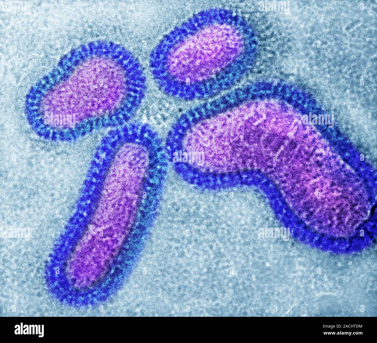 Influenza virus particles, coloured transmission electron micrograph ...