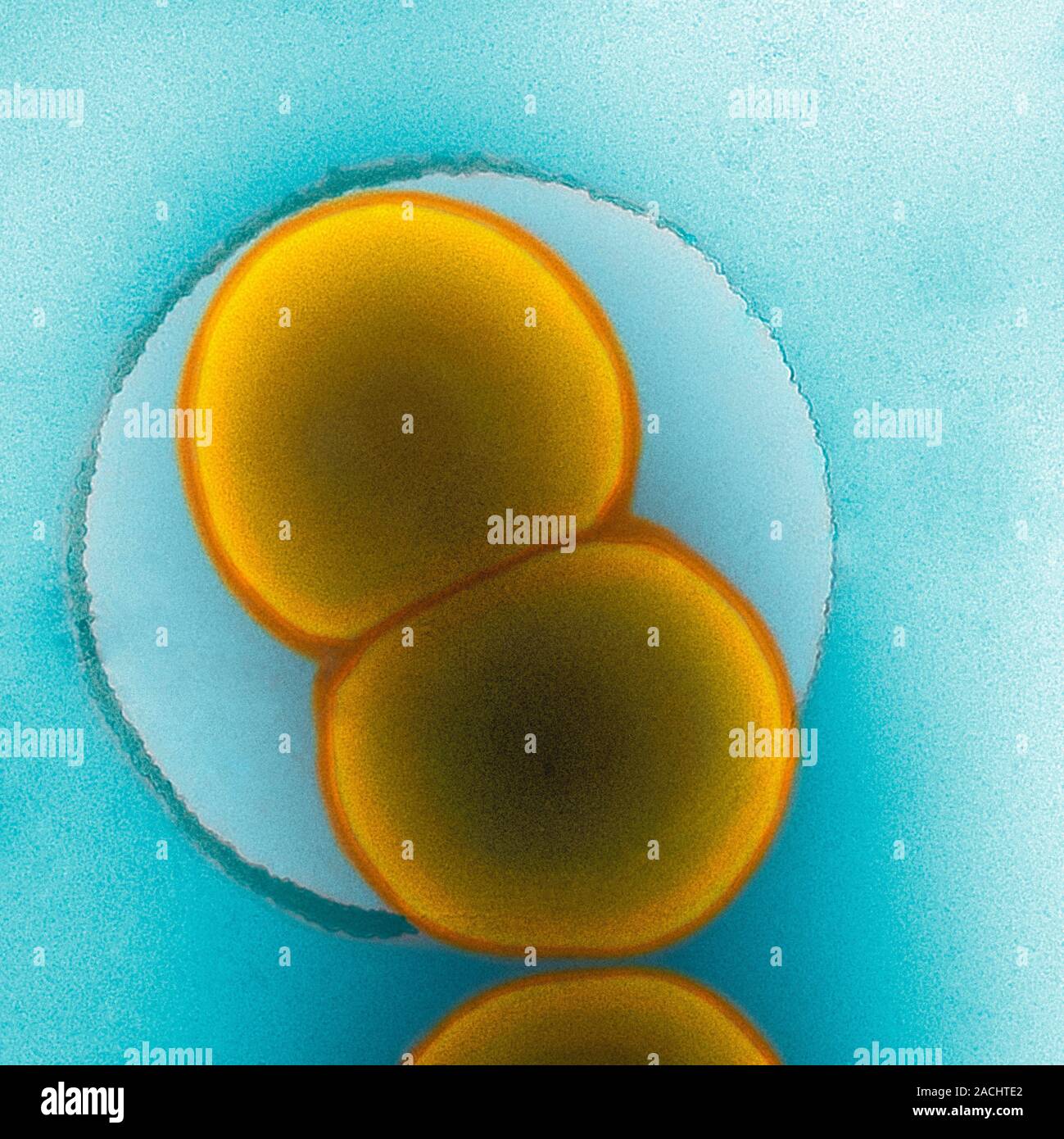 Meningitis C bacteria. Coloured transmission electron micrograph (TEM ...