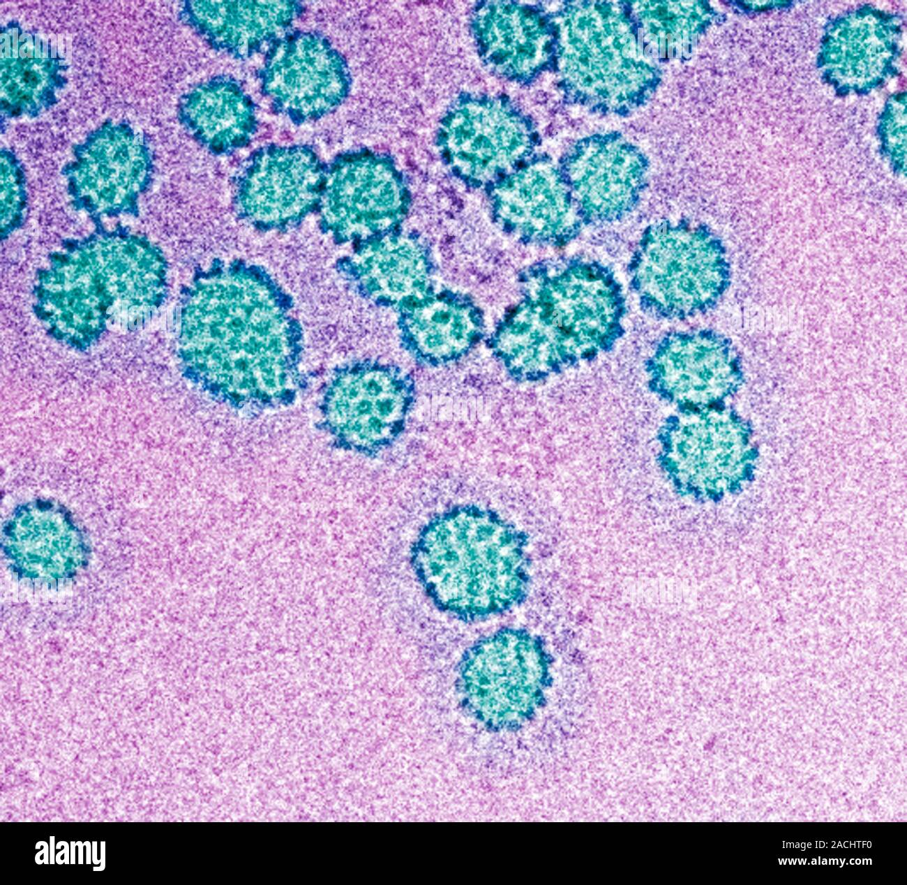 HPV-like particles. Coloured transmission electron micrograph (TEM) of ...