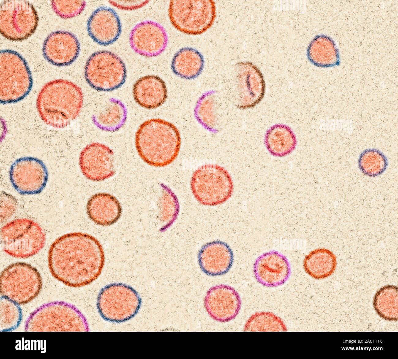 Meningitis B vesicles. Coloured transmission electron micrograph (TEM ...
