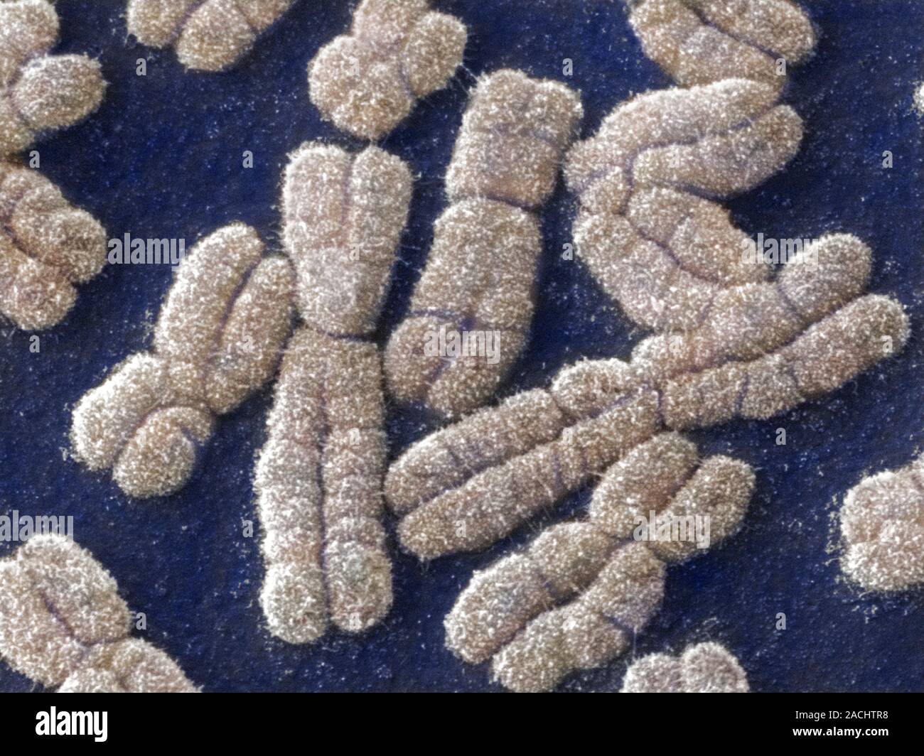 Group of human chromosomes, coloured scanning electron micrograph (SEM ...