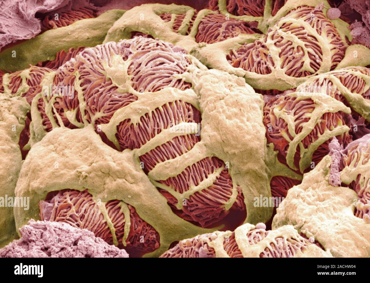 Kidney glomerulus. Coloured scanning electron micrograph (SEM) of ...