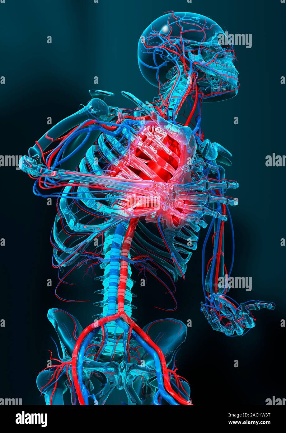 Heart attack. Computer artwork of the head and body of a human skeleton ...
