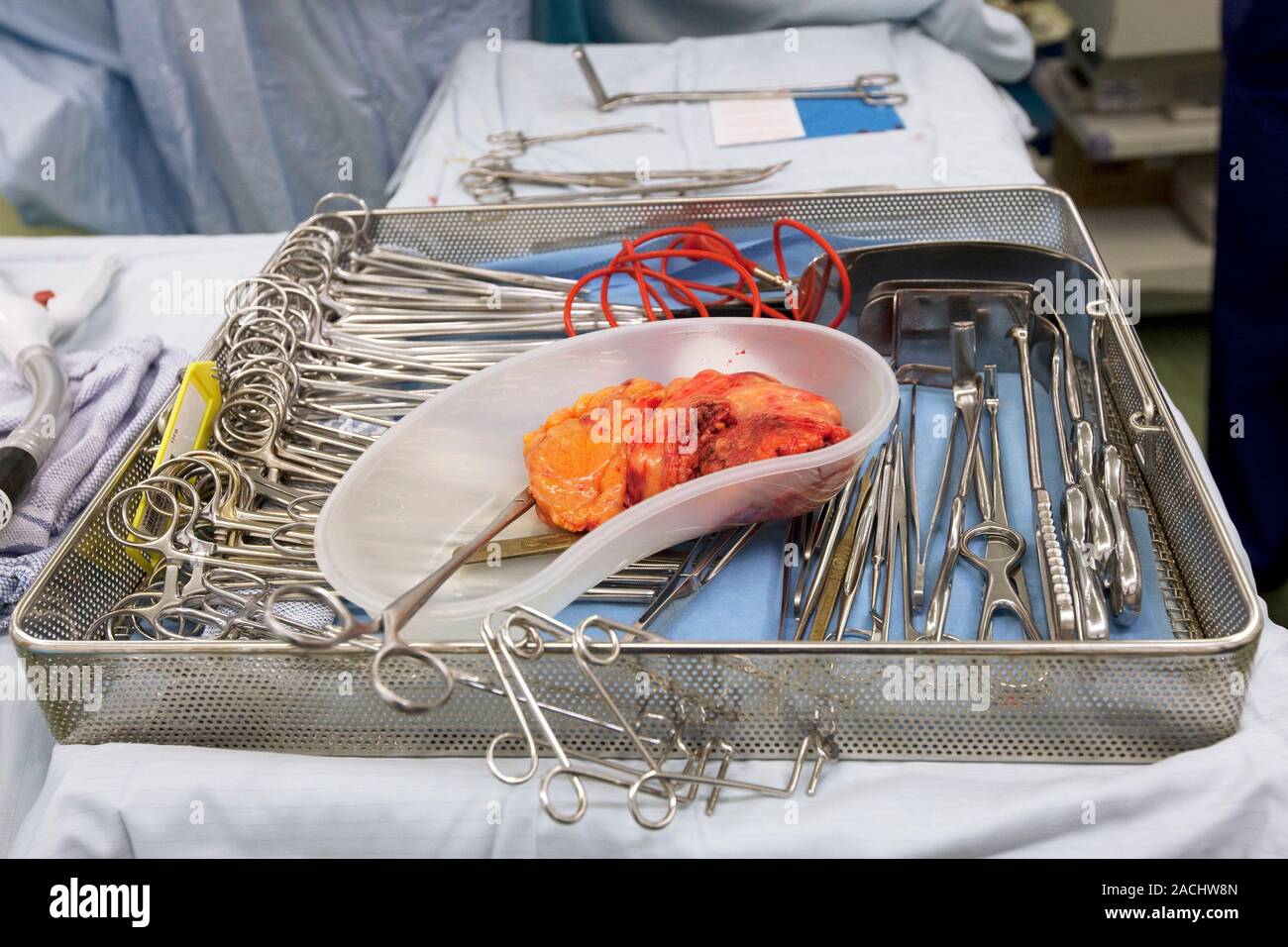 Surgical instruments. Tray of instruments being used during an ...