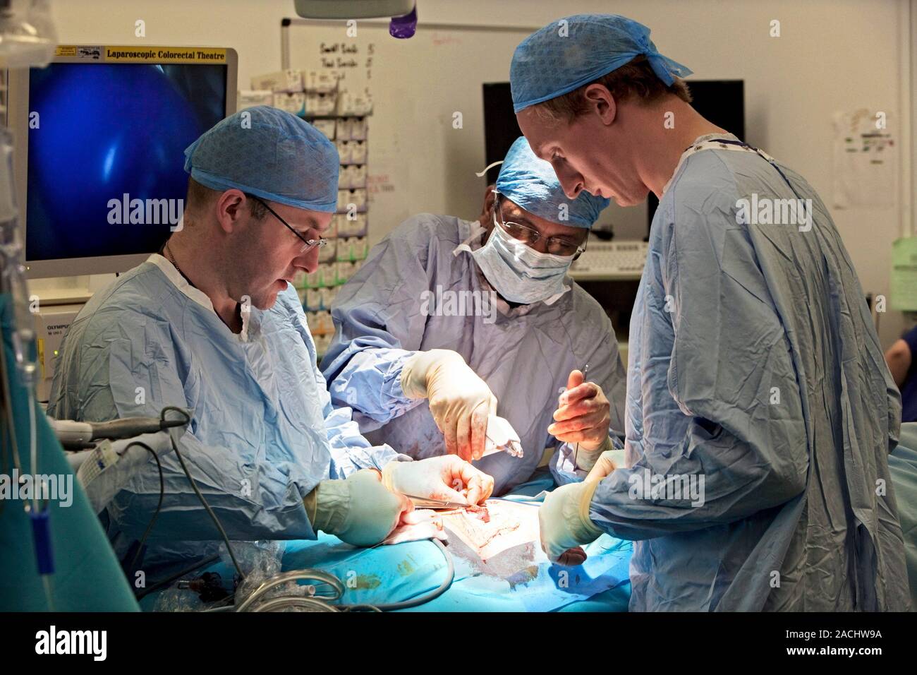 Hernia surgery. Surgeons repairing a bilateral inguinal hernia. A ...