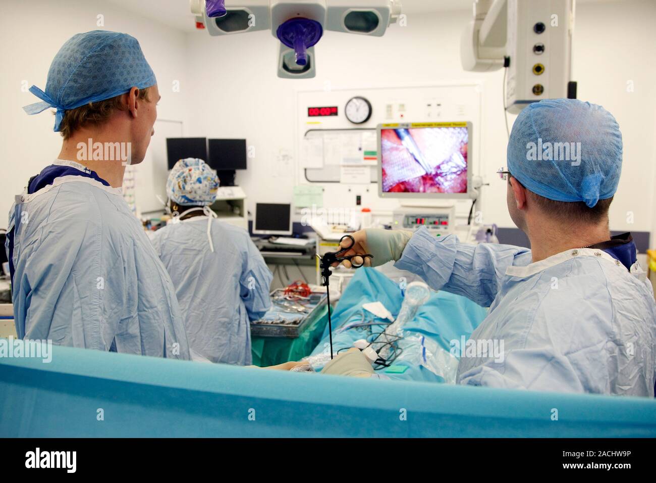 Cancer of the rectum surgery. Surgeons performing laparascopic (keyhole ...