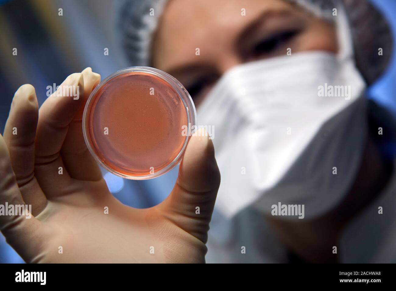 Bacteria research. Researcher looking at a petri dish containing ...