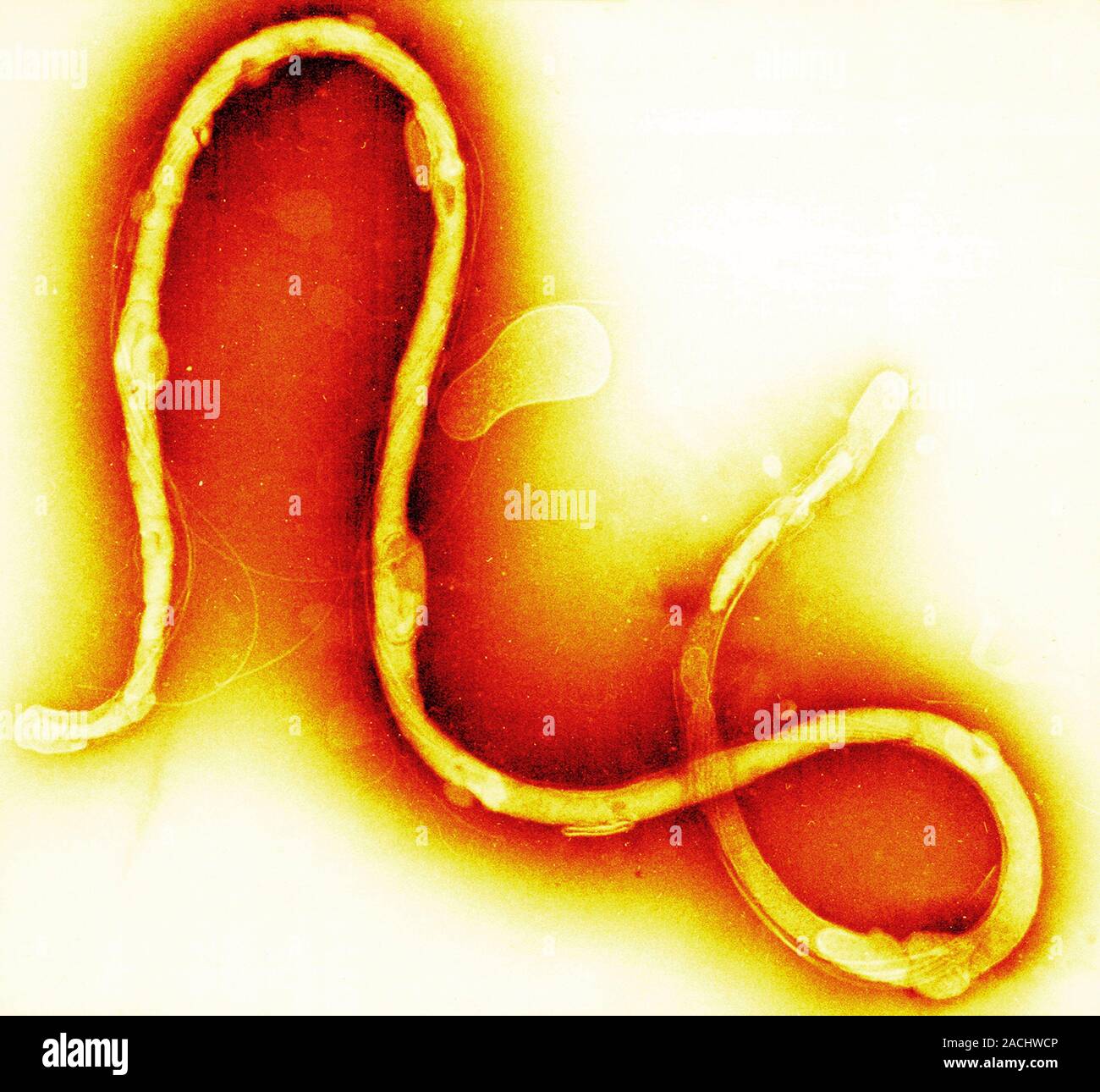 Lyme disease bacterium. Light micrograph of a Borrelia burgdorferi ...