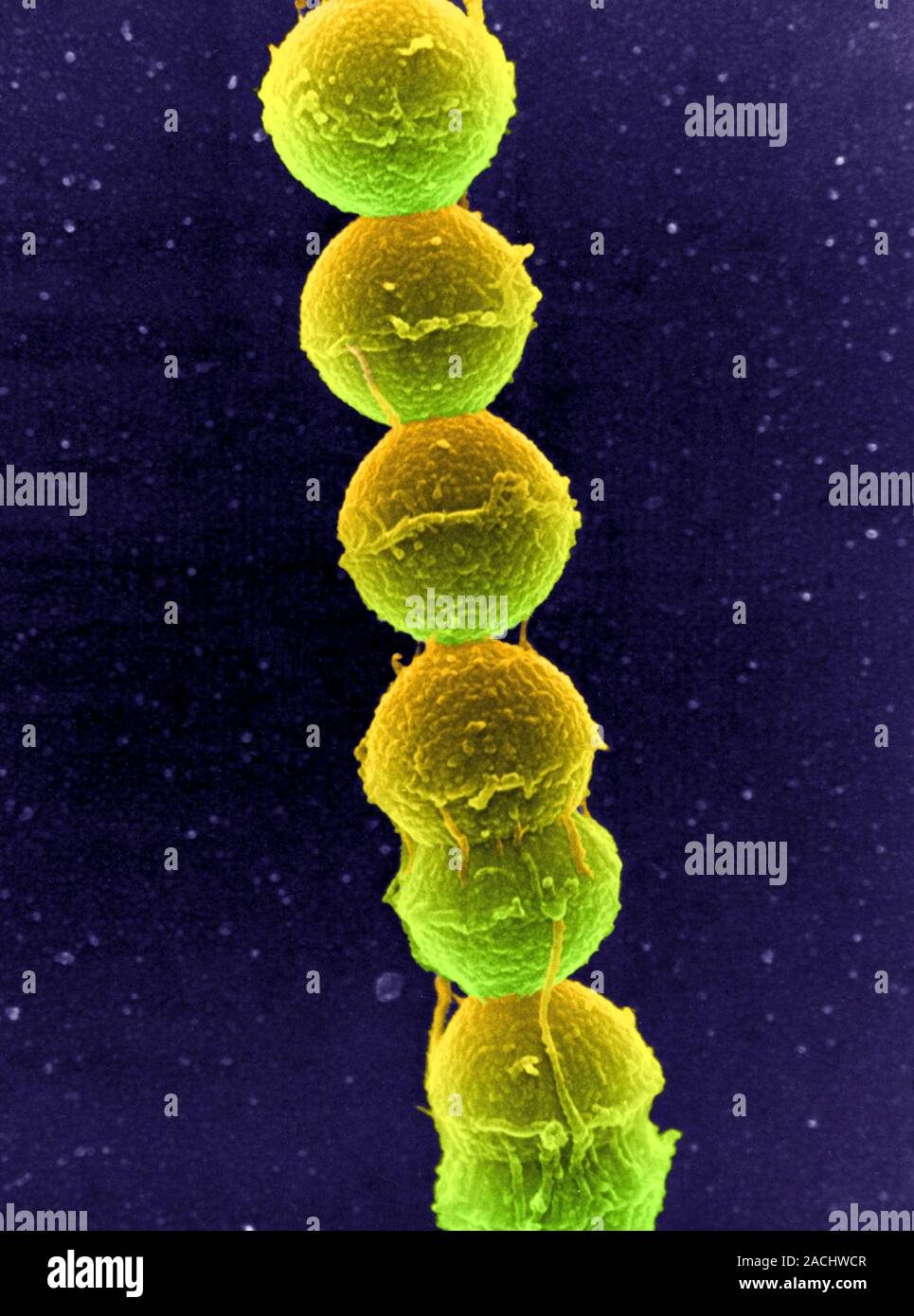 Streptococcus bacteria. Coloured scanning electron micrograph (SEM) of ...