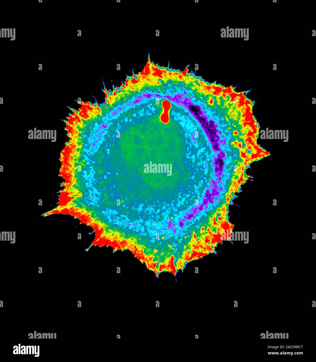 Protein activation. Fluorescent micrograph showing areas within a ...