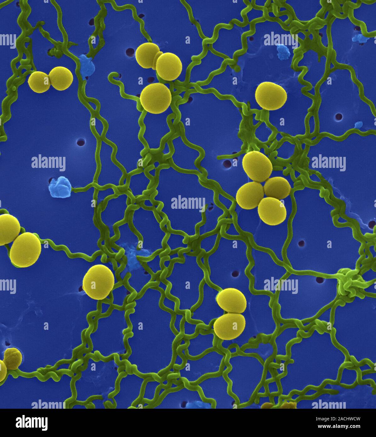 Leptospira bacteria (green), coloured scanning electron micrograph (SEM ...