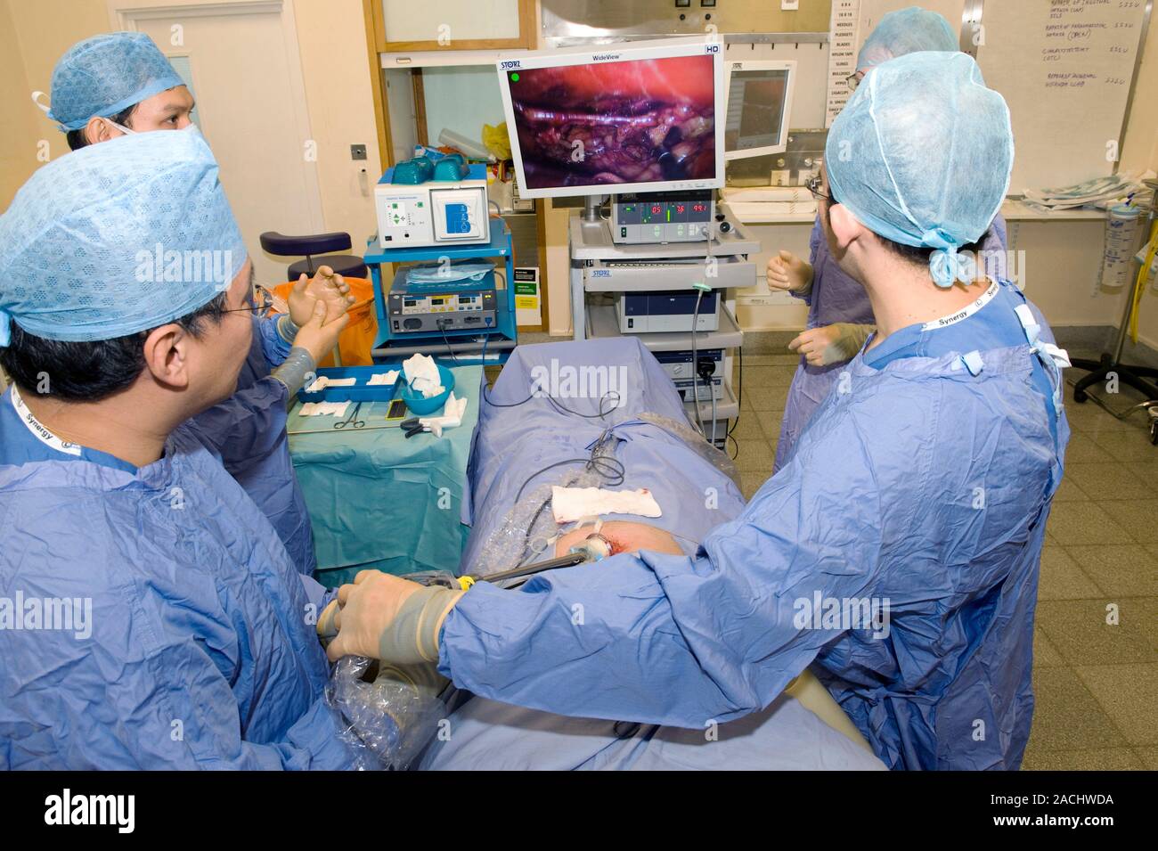 Hernia surgery. Surgeons performing a laparascopic (keyhole) repair of ...