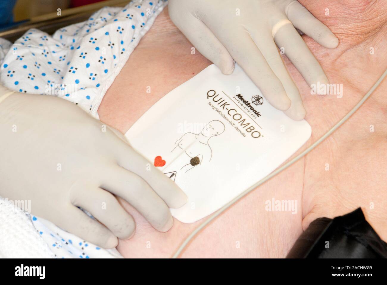 Heart attack patient. Close-up of a medical staff member applying a ...