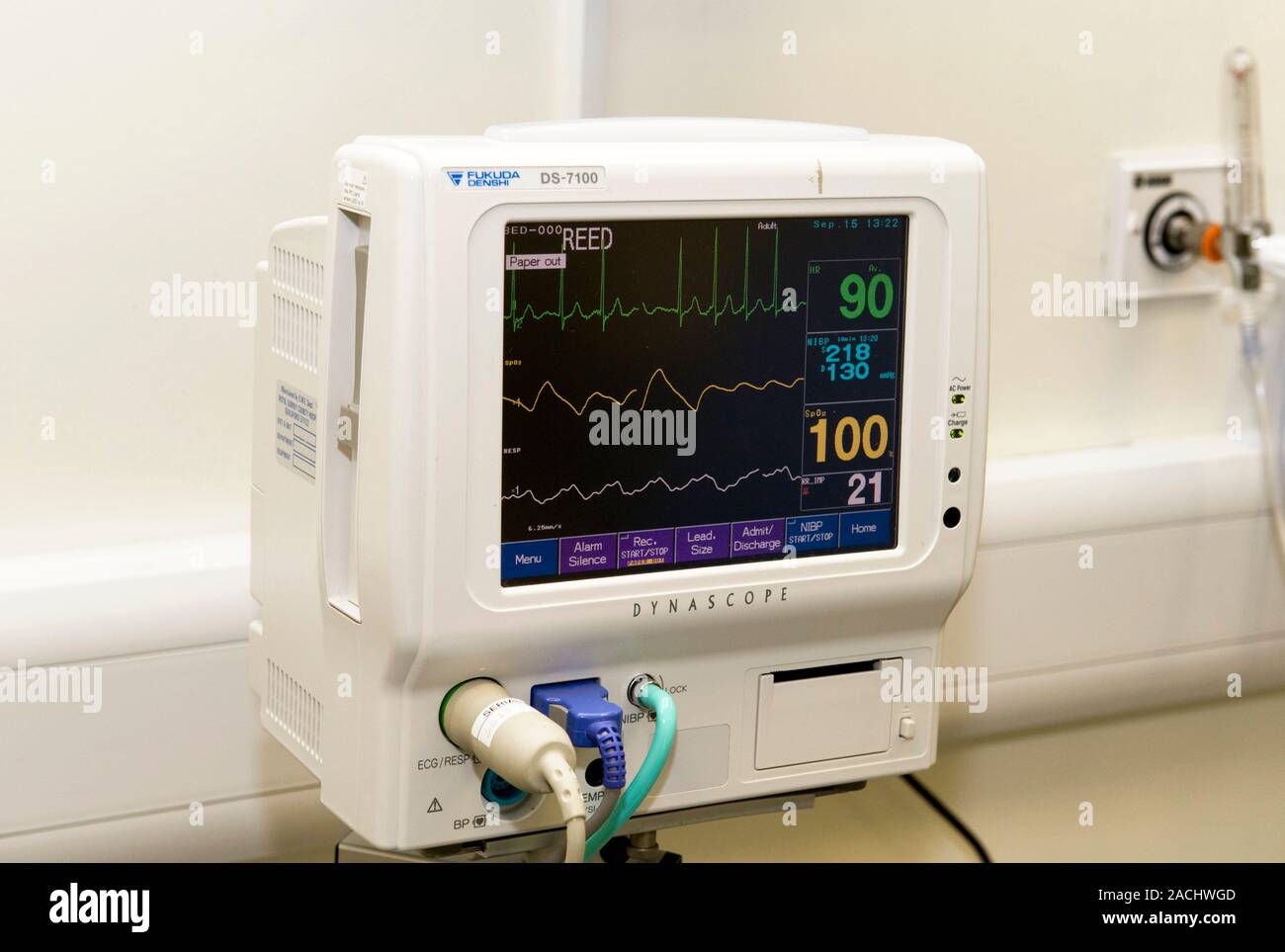 Vital signs monitor. This screen shows a patient's vital signs ...