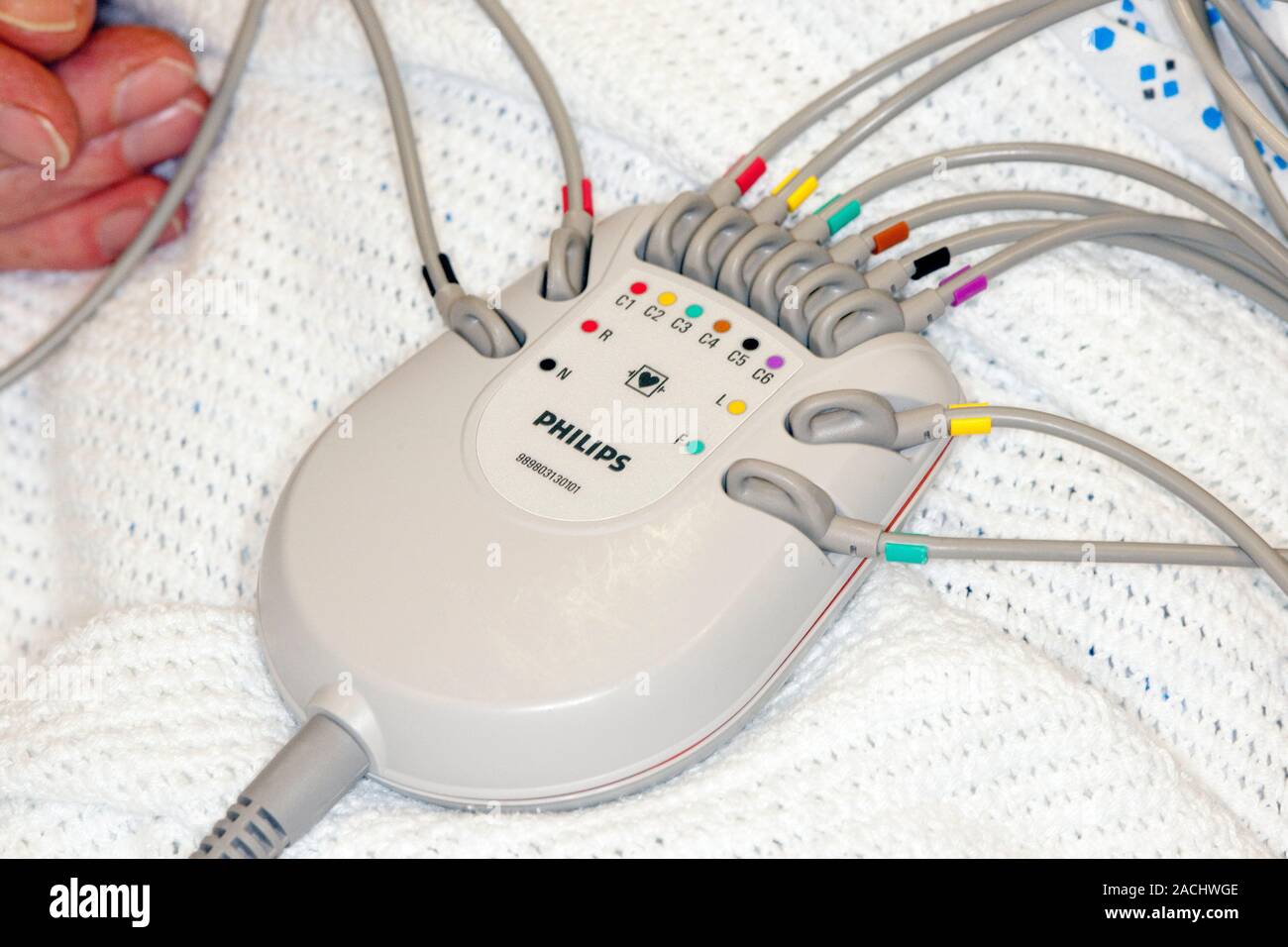 Heart attack patient. Close-up of monitoring equipment on the body of a ...