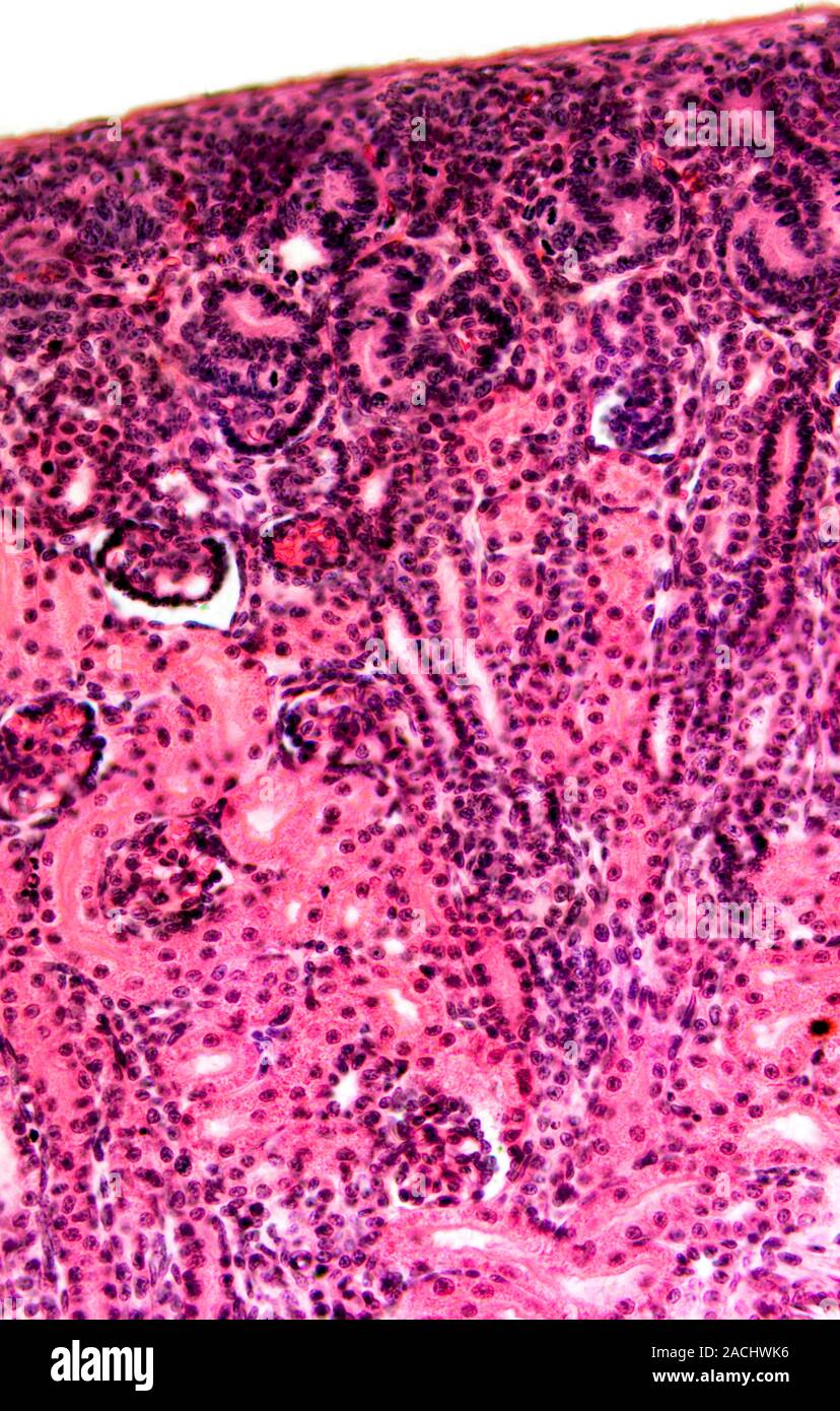 Kidney cortex. Light micrograph of a vertical section through the ...