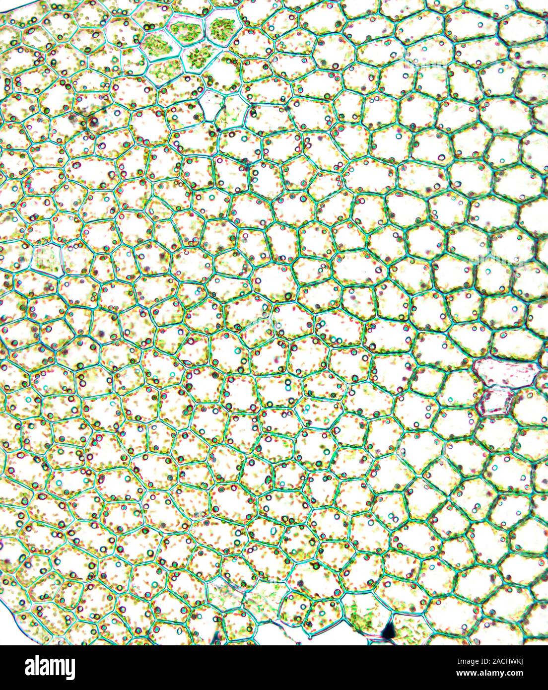 Liverwort leaf tissue. Light micrograph of a leaf from a leafy ...