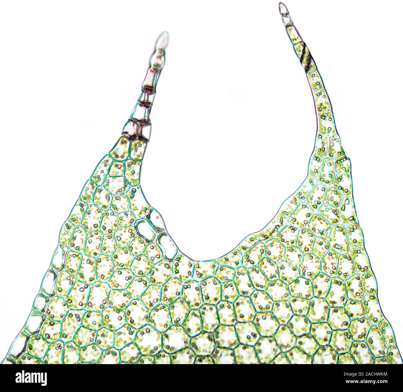 Liverwort leaf tissue. Light micrograph of the bifurcated tip of a leaf ...