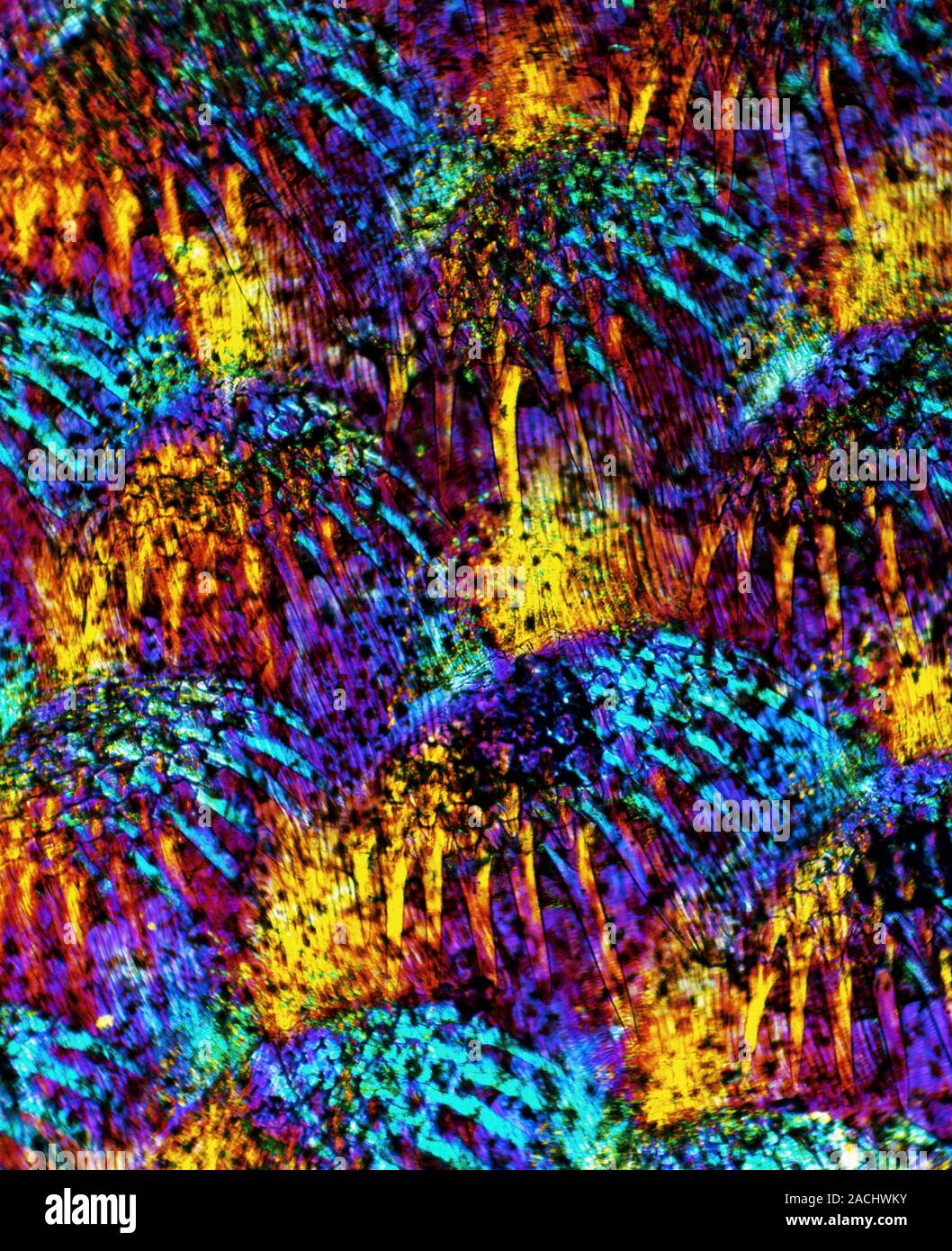 Fish scales. Polarised light micrograph of part of the skin of a fish ...