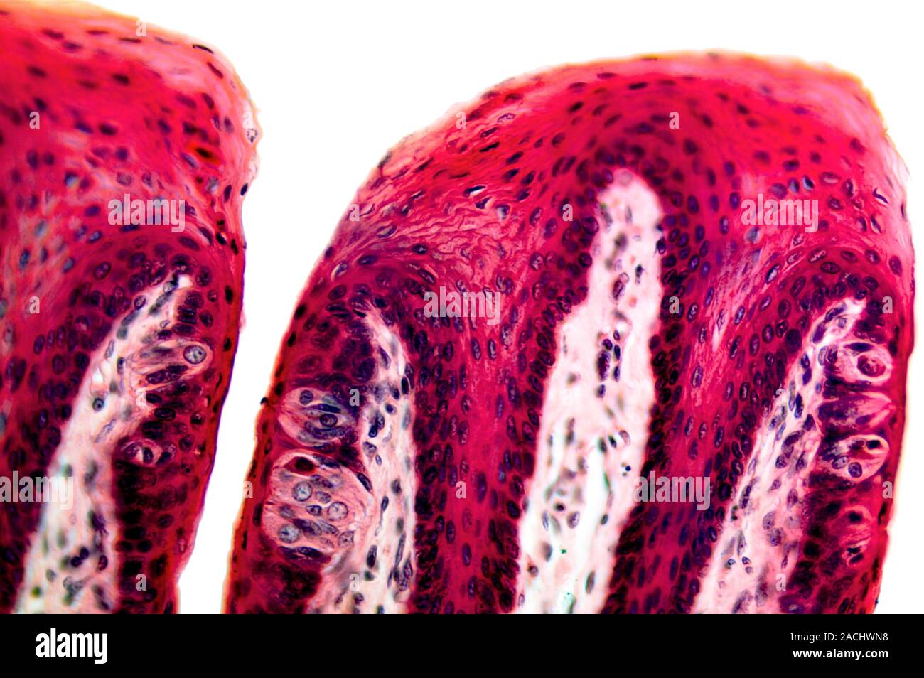 Tongue papillae. Light micrograph of a vertical section through ...