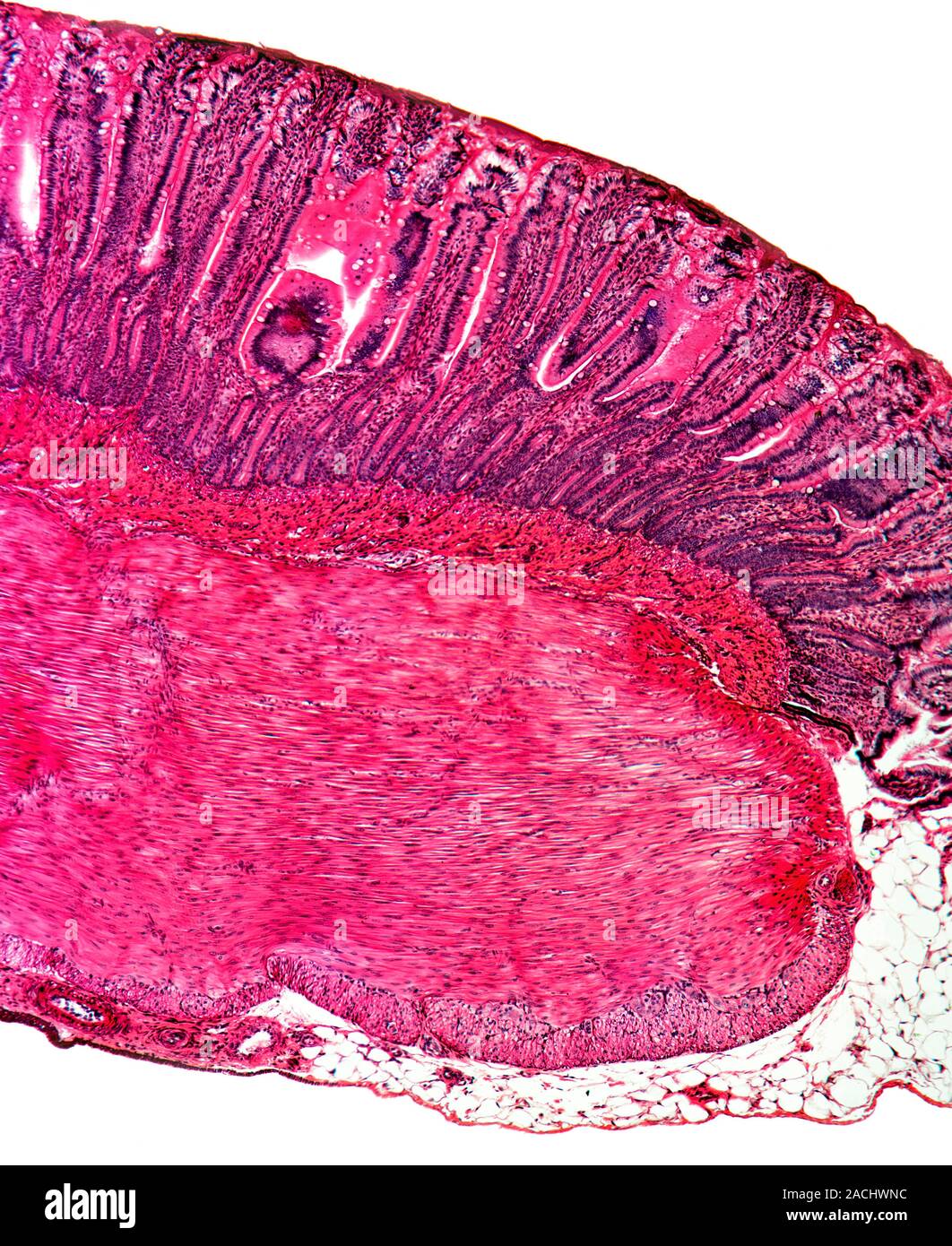 Stomach section. Light micrograph of a vertical section through a ...